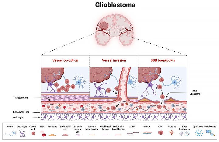 Brain Tumor Biomarker Discovery - Alfa Cytology